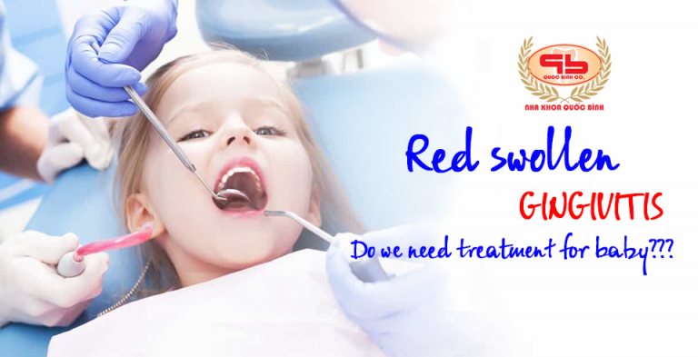 Do you need treatment when your child has red swollen gingivitis?