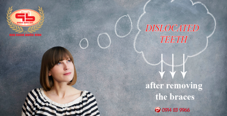 Why have the dislocated teeth after removing the braces?